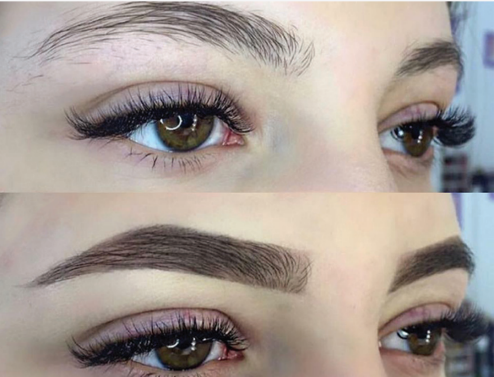 Eyebrow Shaping Experts | Chic Skin & Laser Clinic